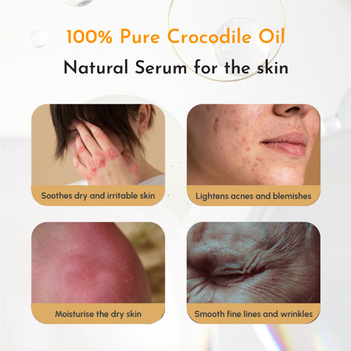 Fei Fah Saltwater Crocodile Oil 50ml (Fragrance) - Natural Skincare ...